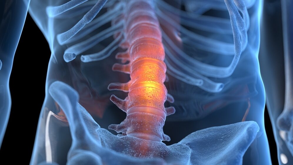 Pittsburgh Spinal Infection Misdiagnosis Lawyers
